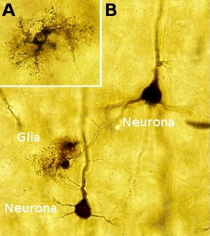 SIRIUS: El teixit nerviós