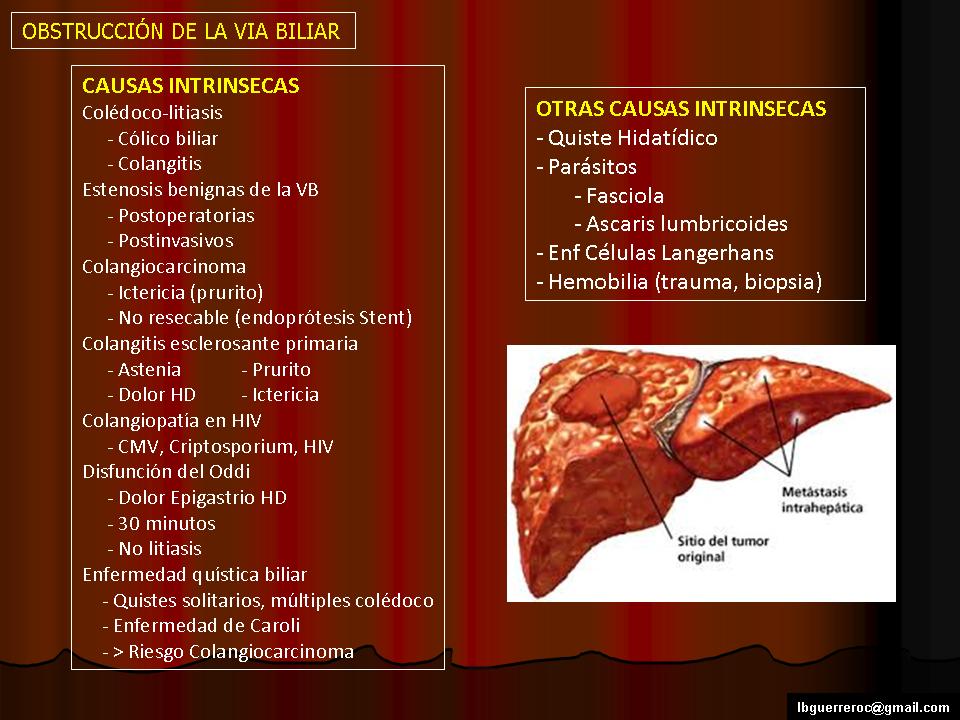 Dr. Luis B. GUERRERO CABRERA: ESTENOSIS de la VIA BILIAR PRINCIPAL