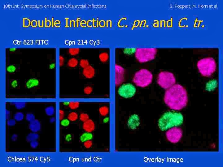 chlamydia diagnosis ~ infectious diseases