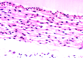 Pathology - Human Pathology