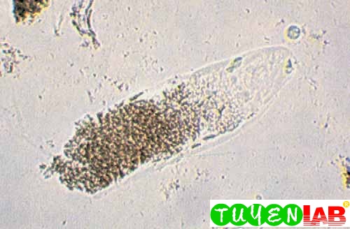 Atlas of Casts in urine | Free Medical Atlas