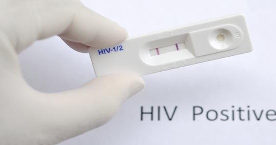 Identifying HIV: Seroconversion Time Is Important - Jokohema