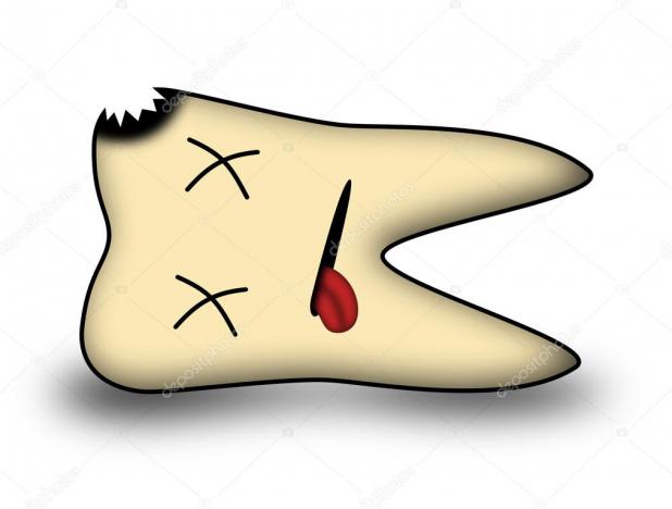 ¿Sabe qué es un diente muerto?