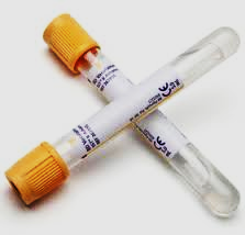 Blog del Laboratorio clinico : Tubos Vacutainer
