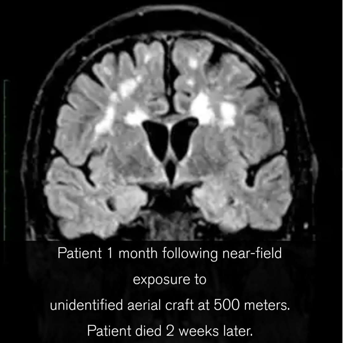 Unidentified Aerial Phenomena - scientific research: The work of ...