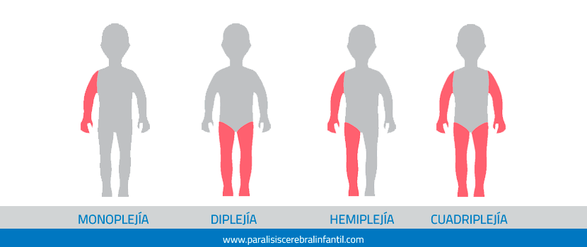 ATENCIÓN A LA DIVERSIDAD