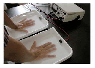 Ionophorèse - Iontophorèse: Ionophorèse