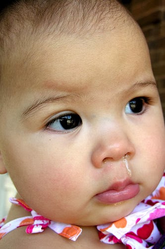 cara mengatasi hidung meler pada anak | pengobatan herbal alami