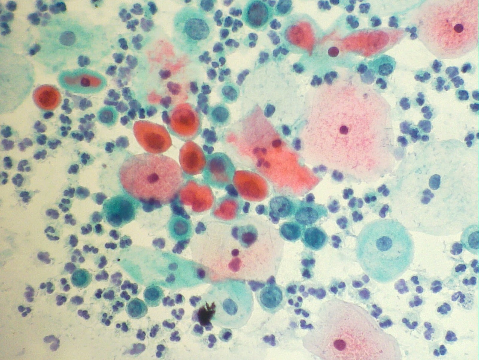 The Cell Hunter Society: Case No. PAP4420-11