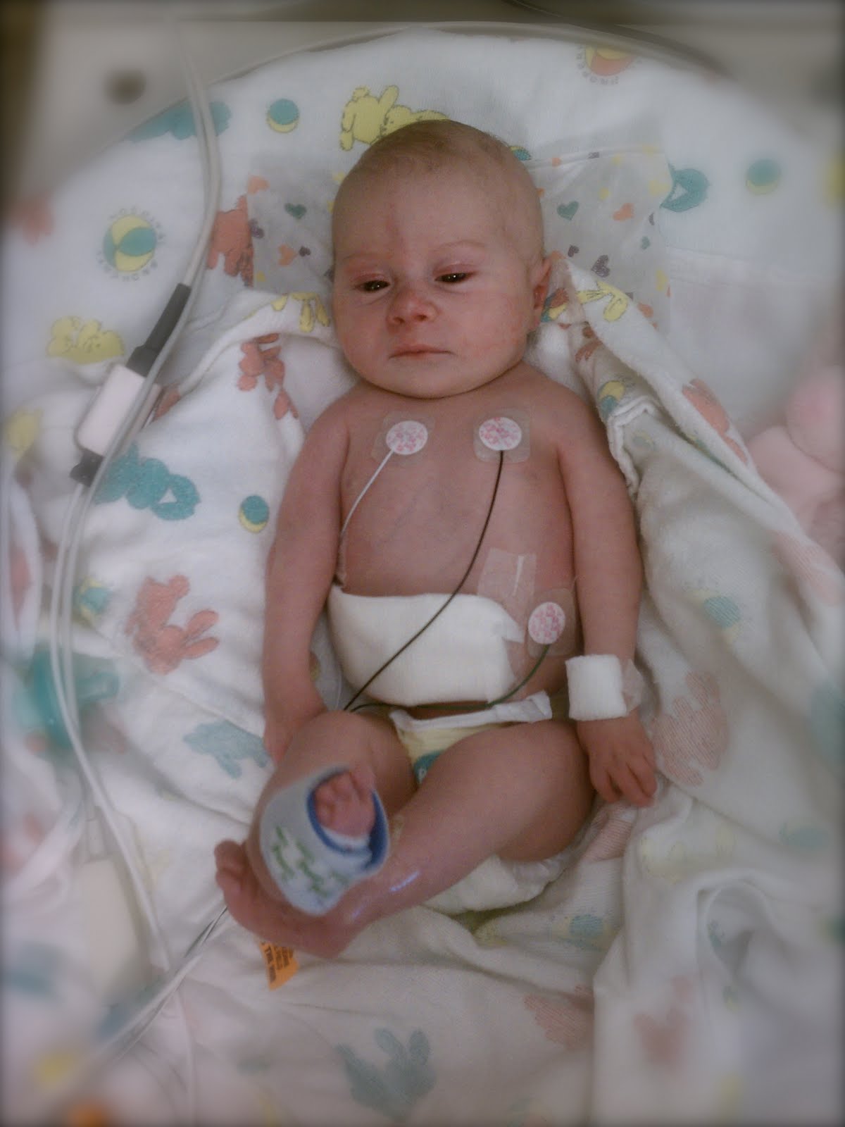 Sweet Analise Rose's Journey with Arthrogryposis, Amyoplasia type: Day ...