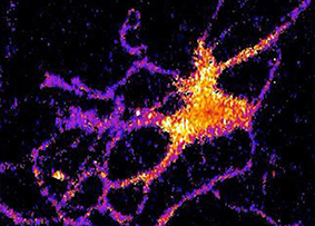 Le Cerveau de l'Enfant et de l'Adolescent: L'Optogénétique – La ...