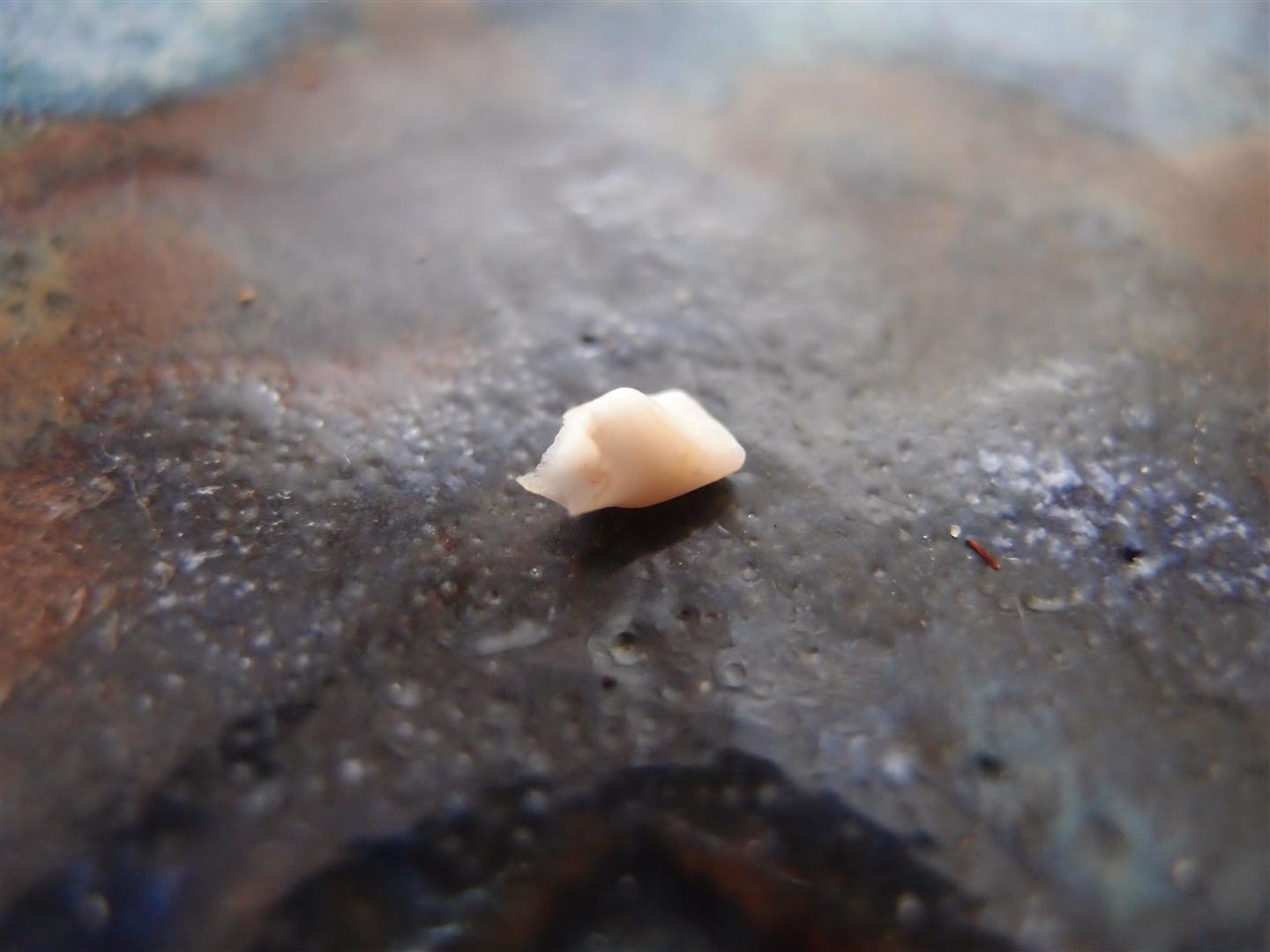 Life of Louka: First wobbly tooth