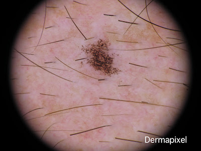 Dermapixel: mayo 2019