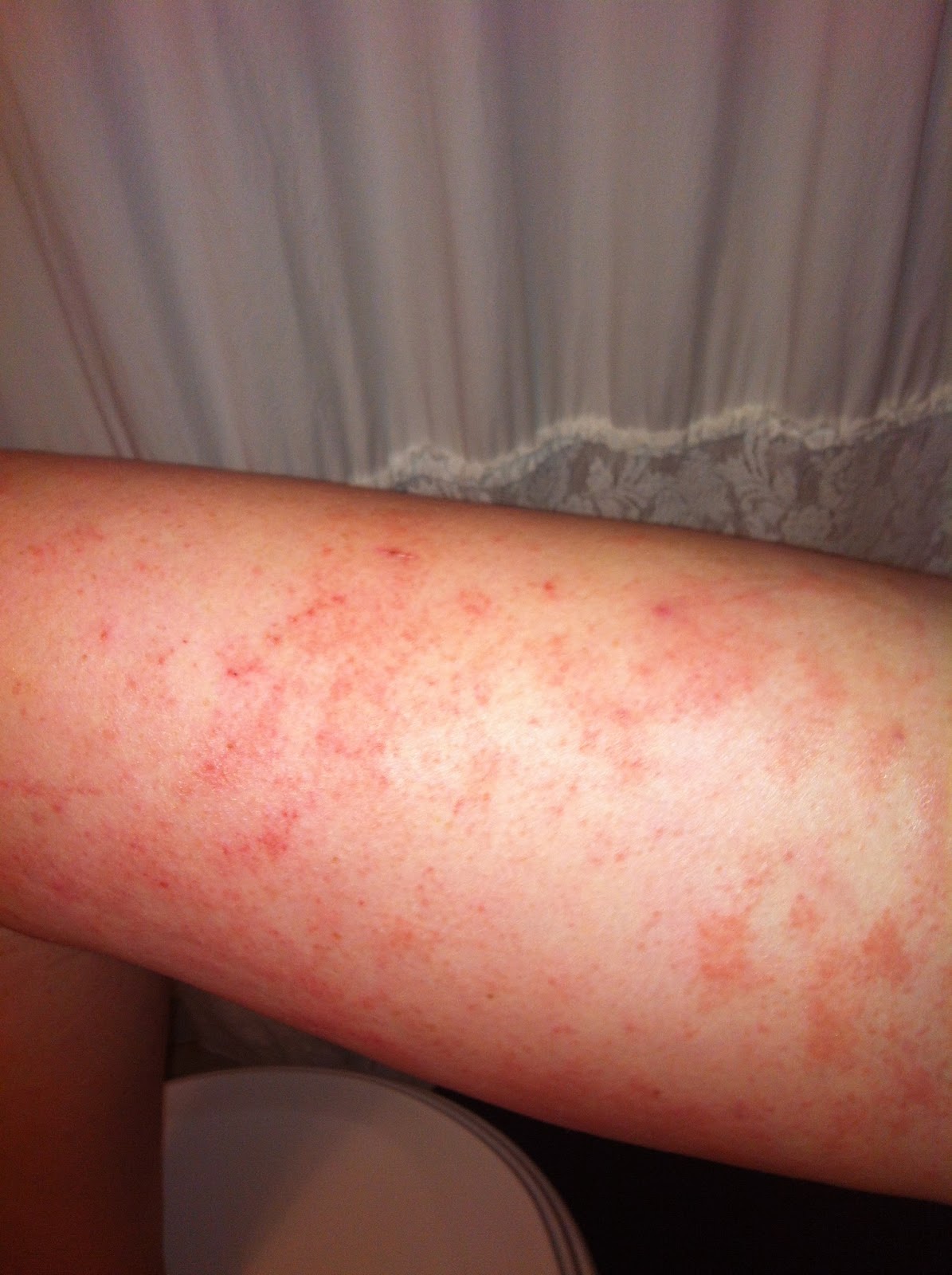 This Itchy Life: January 2013