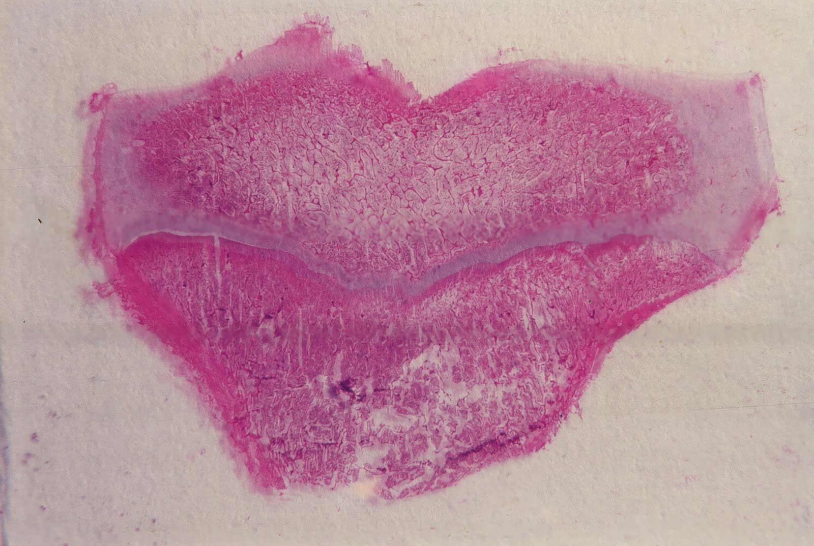 Patologia Veterinária: Raquitismo em bezerros