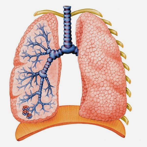 Zdravlje i sloboda: BRONHITIS