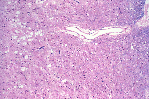 Medical Laboratory and Biomedical Science: Pathology of Infectious Diseases
