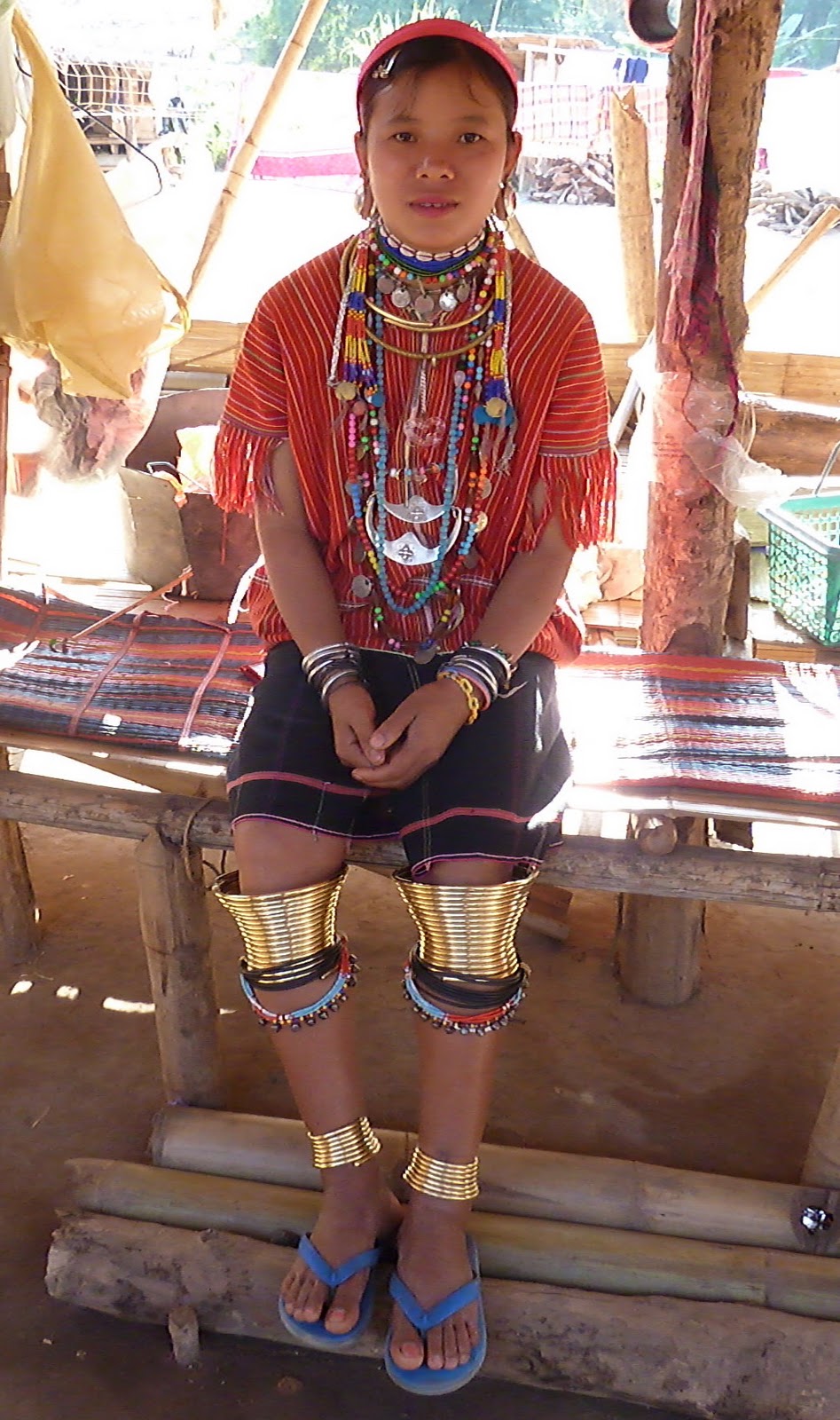 Much Ado About Us: Karen Long-Neck Tribe, a Human Zoo