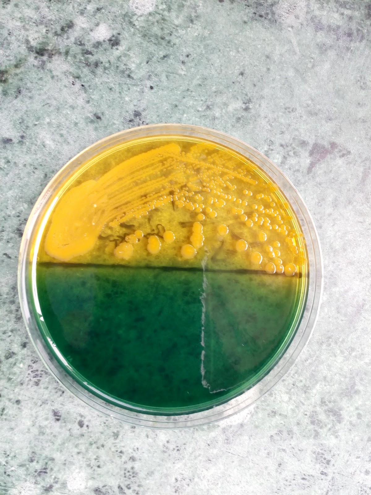 MICROBIOLOGY BLOG FOR STUDENTS (MBLOGSTU): Cultural and Biochemical ...