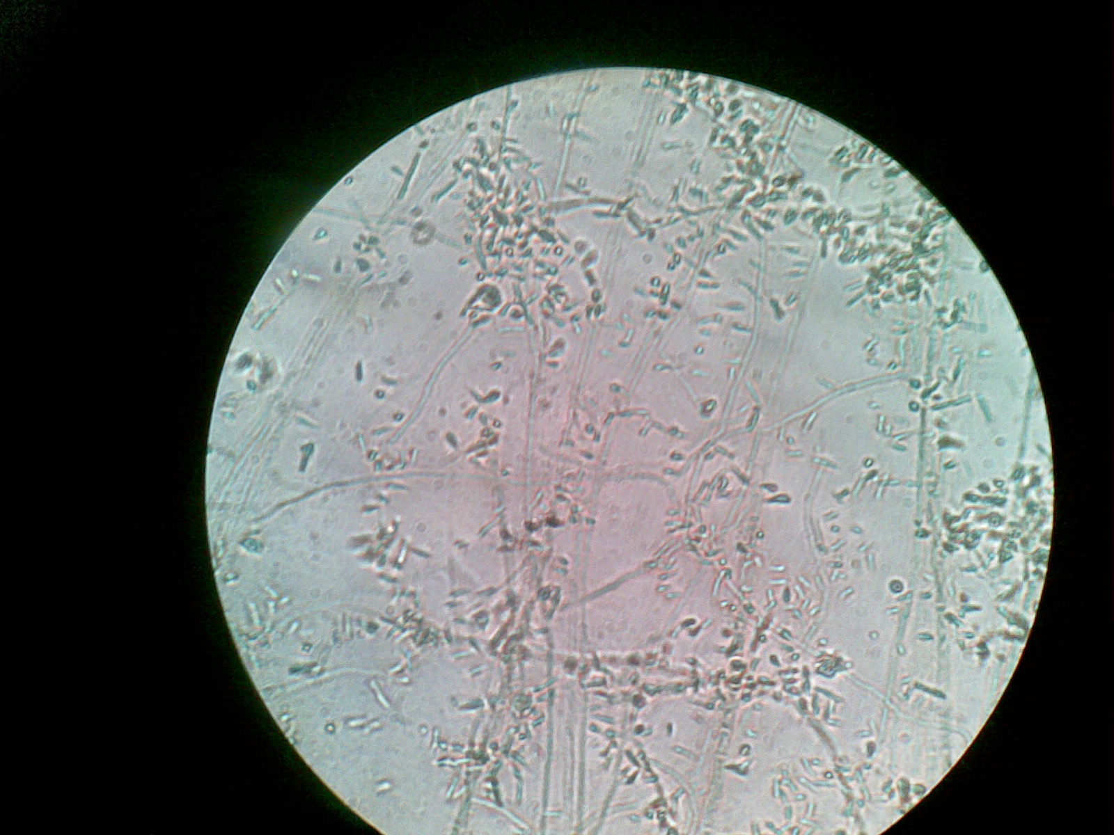 Ca - CaDo (Catatan Calon Dokter): Blok 9 : Praktikum Mikrobiologi ...