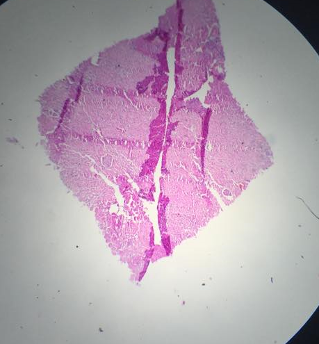 PROCESAMIENTO HISTOLÓGICO.: CORTES HISTOLÓGICOS CON ARTEFACTOS