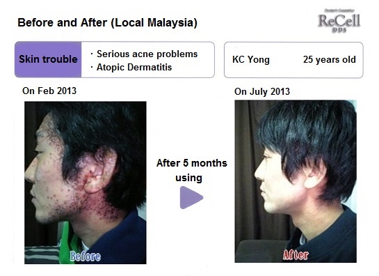 ReCell Japan ~skin regenerate beauty essence~ @ Malaysia: Local test ...