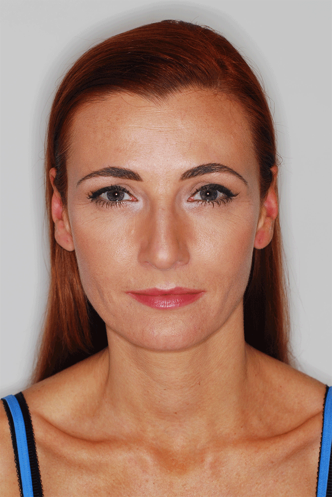 My 40 Year Old Face | Is There Beauty In Symmetry? - Not Dressed As Lamb