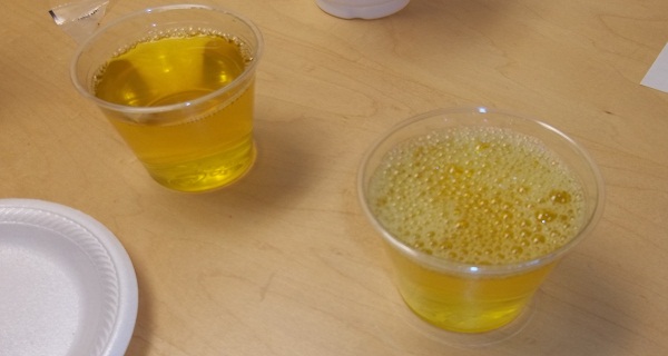 Ce que révèle la mousse dans votre urine ? - Conseils pour vous