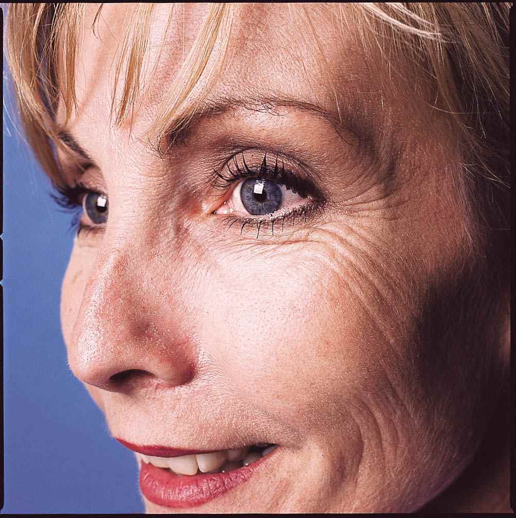 Então, vamos lá!!! LIVE LIFE ️ VIVER A VIDA Fátima Camargo : TIPOS DE RUGAS