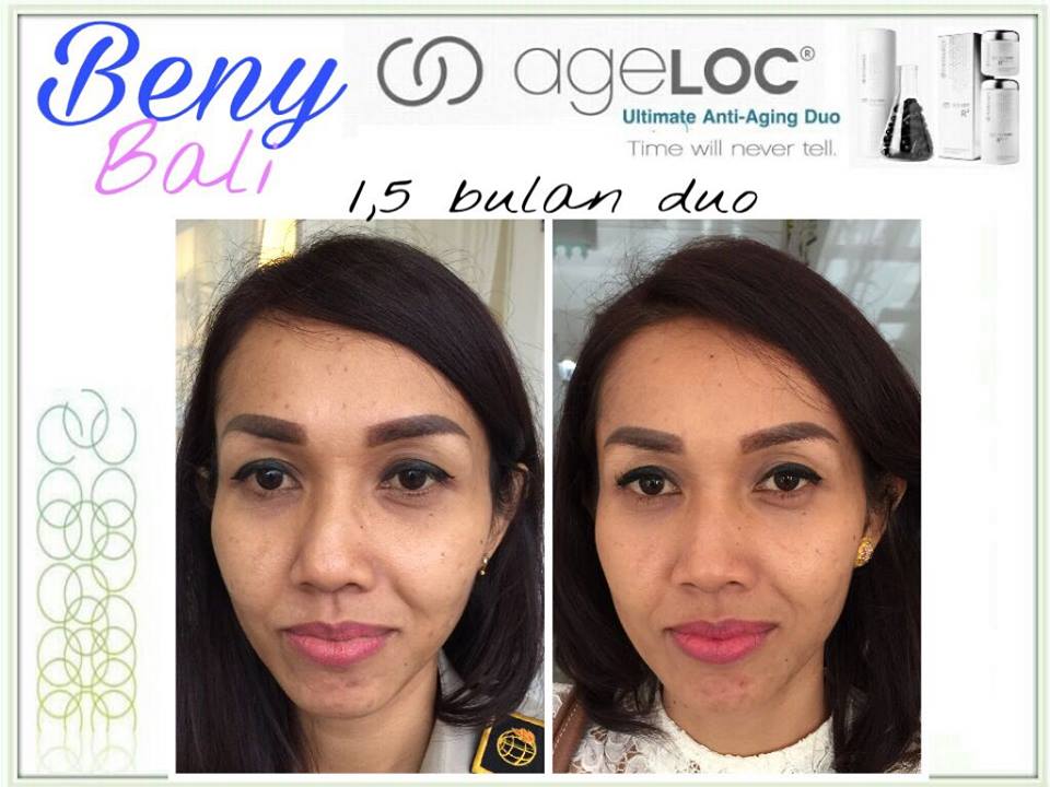 Jual Nuskin Ultimate Anti Aging Duo AgeLoc R2 AceLoc Y-Span: TESTIMONI ...