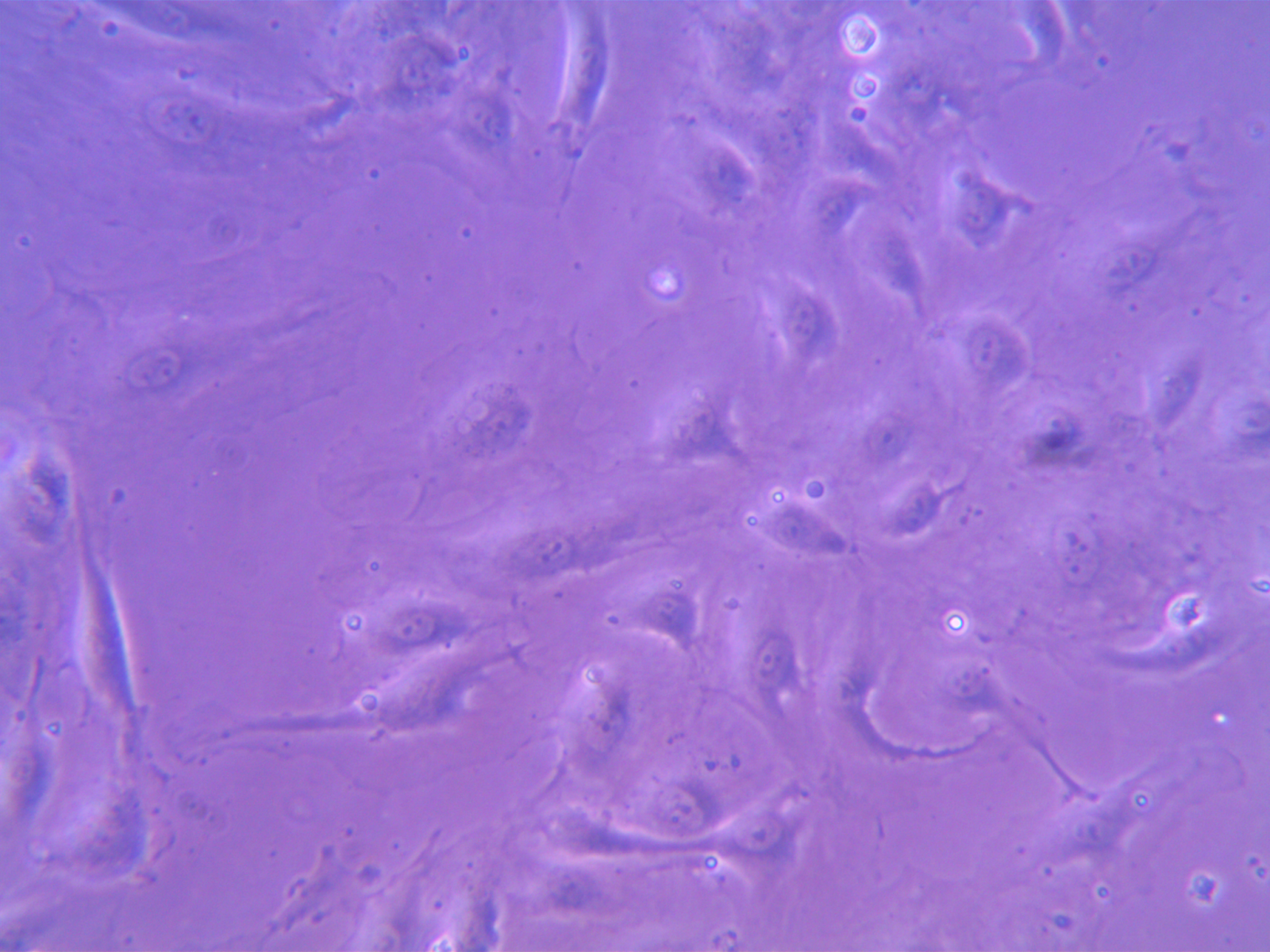 Neuromics: Large Intestine Endothelial Cells