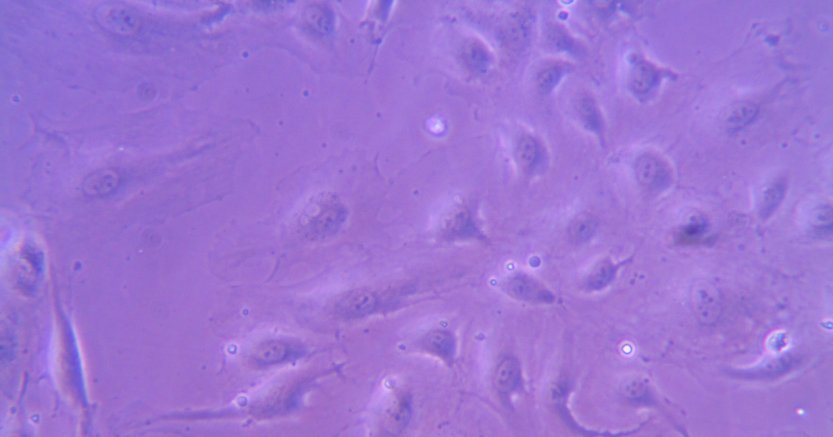 Neuromics: Large Intestine Endothelial Cells