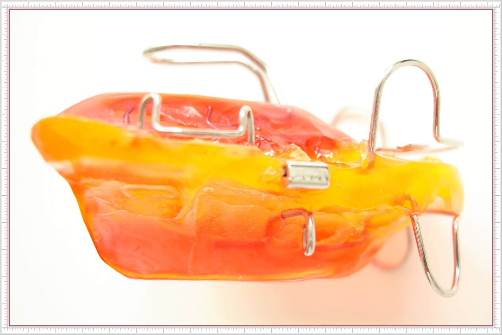 Функционални ортодонтски апарати ~ Медико-техническа ортодонтска ...