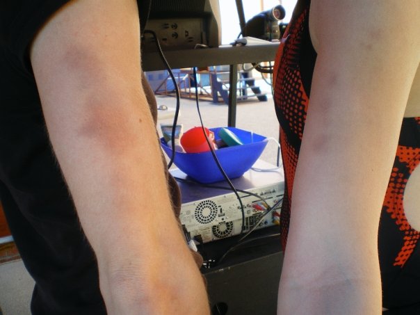 Flying High: Diving Injuries