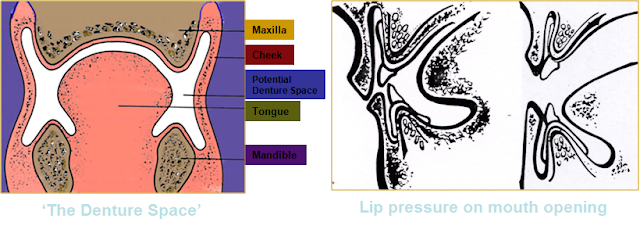 Dentistry and Medicine: Concept of Neutral Zone