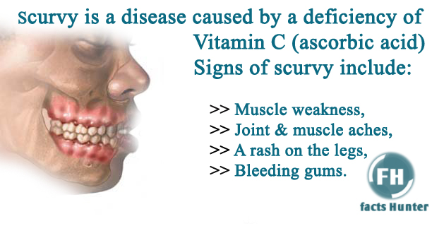 Aye Aye you scurvy barstards ...