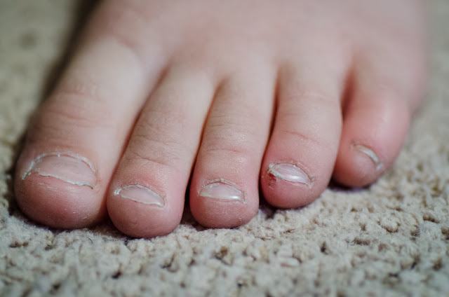 Summer Sausage and Pepperoni: Toes and Things