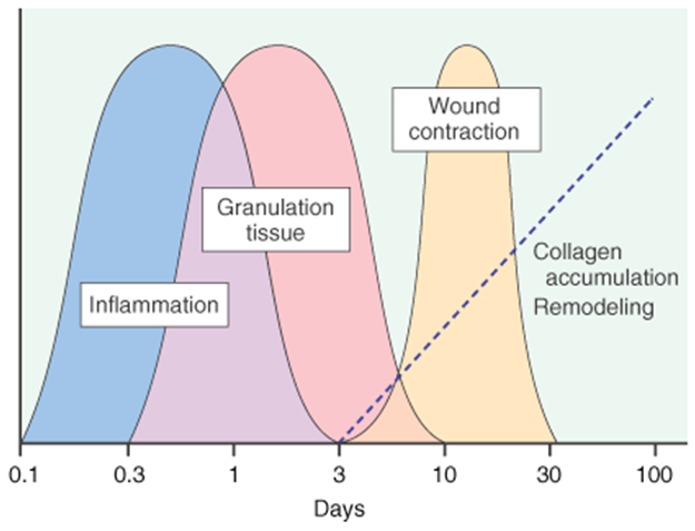 Dentistry and Medicine: Regeneration healing (repair)-General Pathology ...