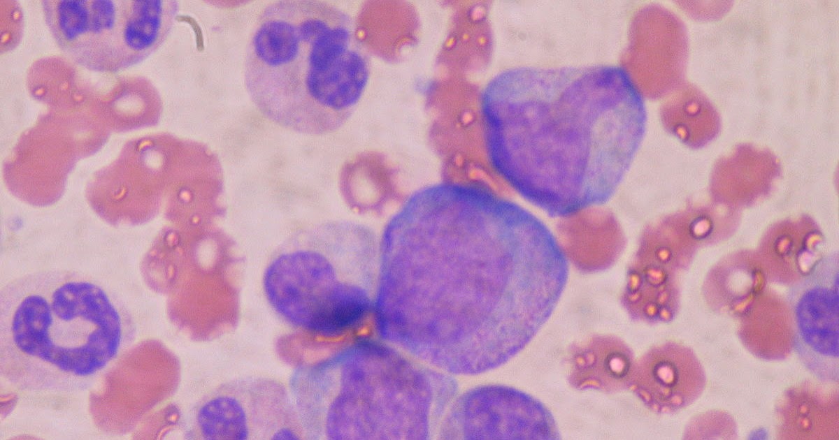 IDENTIFICAN LAS CÉLULAS MADRE CLAVE PARA REGENERAR LA SANGRE Y EL ...