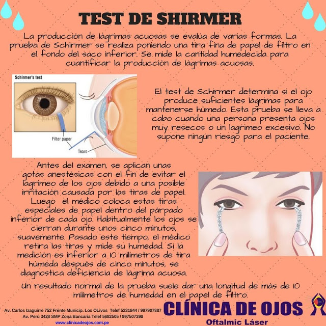 Clínica de Ojos Oftalmic Láser: TEST DE SHIRMER