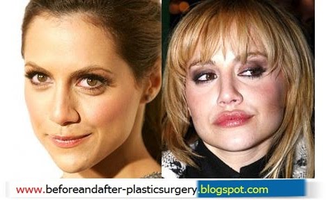Brittany Murphy lips | Before and After Plastic Surgery Celebrity 2011 ...