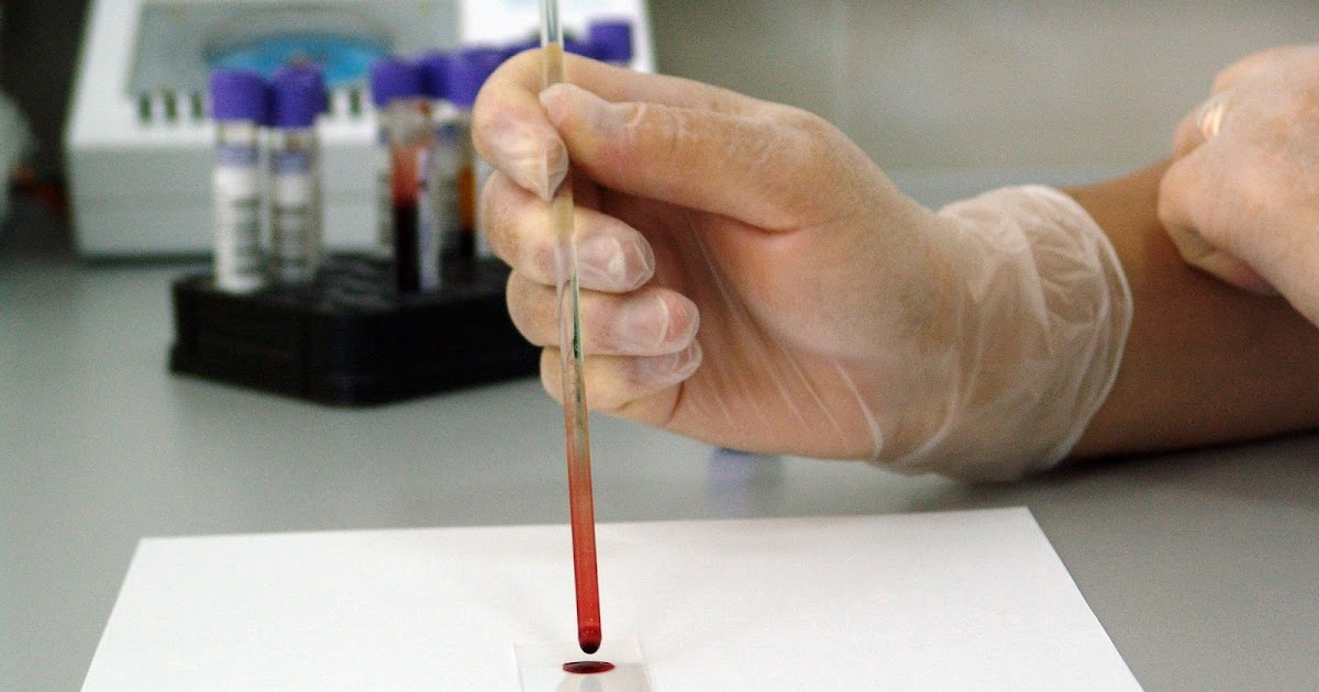 Cross-match en trasplante renal: qué es y en qué consiste.