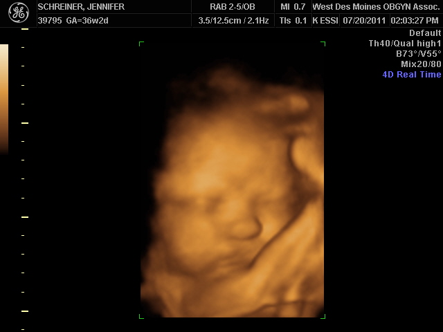 the schreiners: 36 week ultrasound