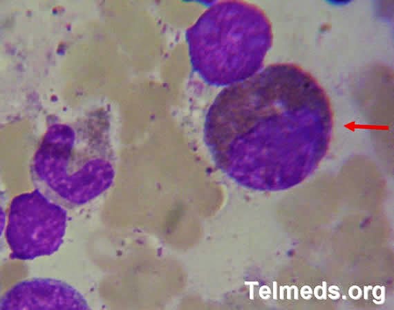 ATLAS HEMATOLOGICO: octubre 2014