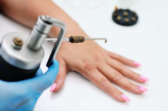 Cara Mengobati Kutil yang Efektif - Cara Merawat Kulit Wajah