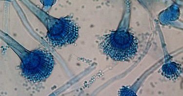 SENTHIL PRABHU SIVASAMY: Fungal Staining by Lactophenol Cotton Blue ...