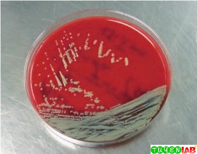 [Microbiology] Atlas of Staphylococci | Free Medical Atlas