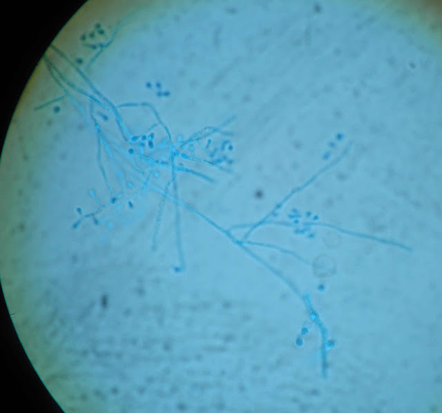 ATLAS MICOLOGIA: TRICHOPHYTON INTERDIGITALE