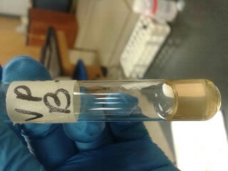Microbiology EJournal: Day 31-Ran the VP test on both Bacterias and ...