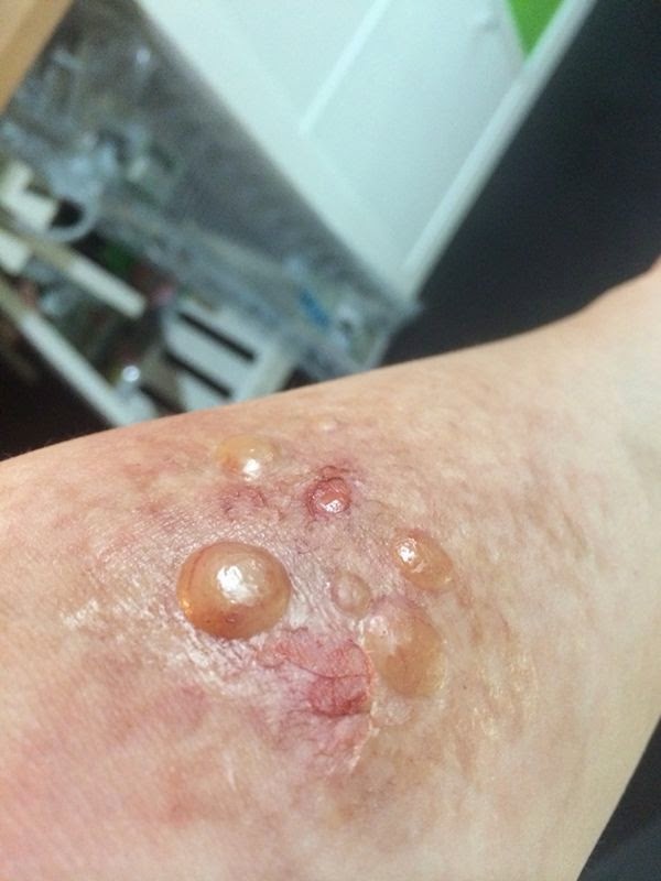 Red Ngoh: -Special Make-up Effects (SFX)